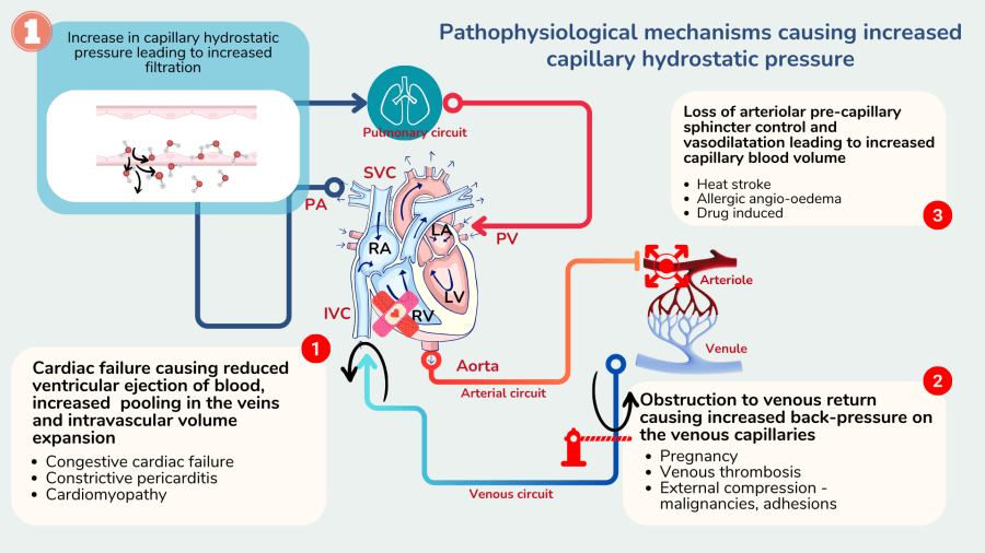 Fluid homeostasis and oedema – Blood & Water